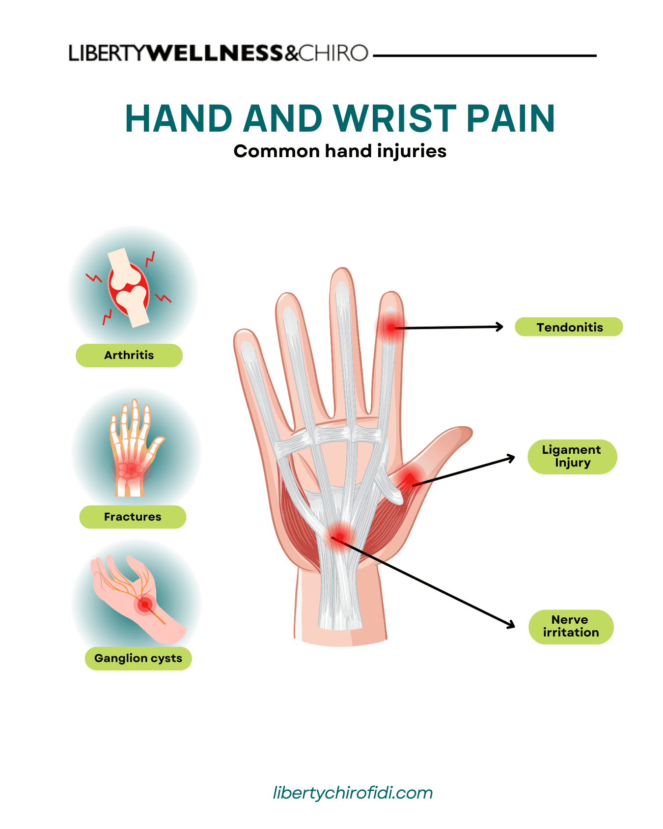Hand & Wrist Pain Treatment, NYC - Liberty Wellness & Chiro.